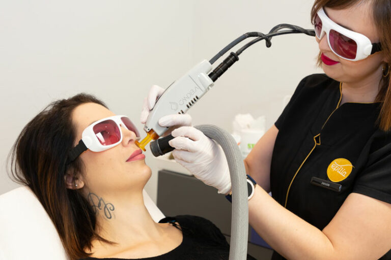 L'épilation laser du visage 2026